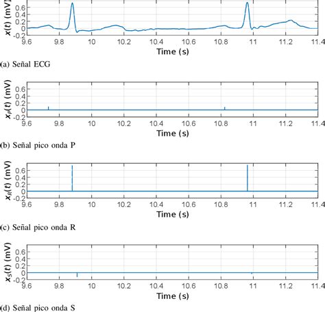 Figure 3 From Multiclass Classification Of Cardiac Rhythms On Short Single Lead Ecg Recordings
