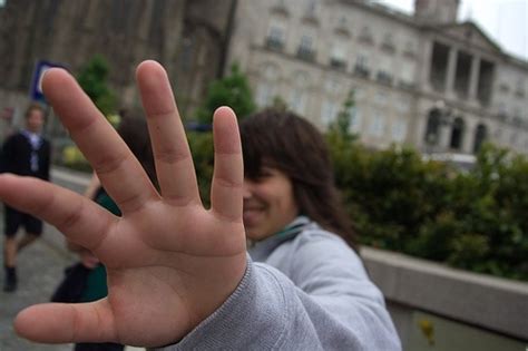 Palm Line Detection Object Detection Dataset And Pre Trained Model By