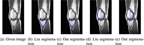 Successful Selective Segmentation Comparison Of Both Liu And The