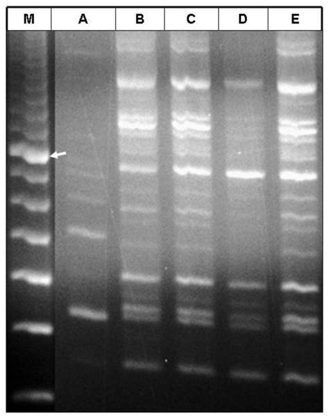 Lysis Buffer Position For Dna Extraction Bios Pics