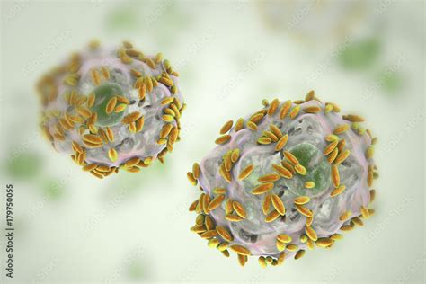 Microscopic Diagnosis Of Bacterial Vaginosis Vaginal Secretions