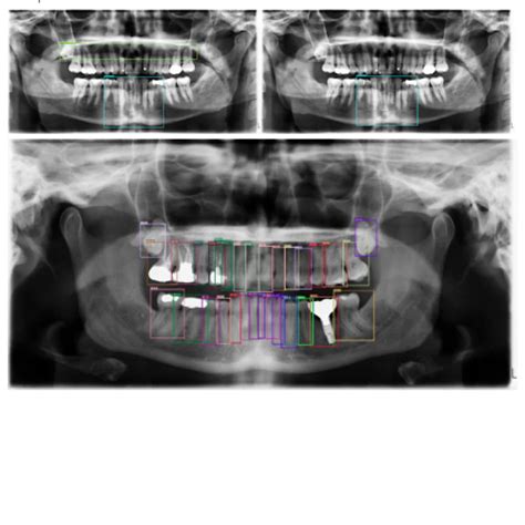 utilizing ai for precise detection and diagnosis of dental conditions 7steps ai