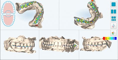Itero Element Scanners All Smiles