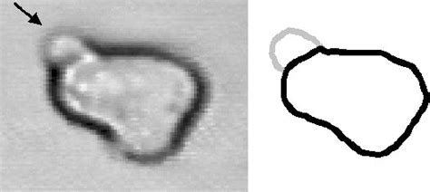 Two Types Of Pseudopods Arrows A Continuous Membrane Type B Download Scientific
