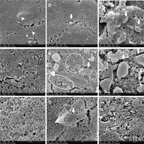 Scanning Electron Microscopy Sem Osteocytes Arrow A And A