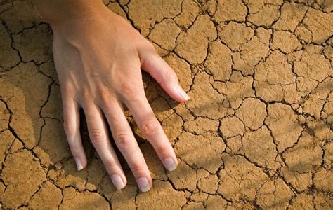 Почему трескается кожа на руках Блог компании Leomax