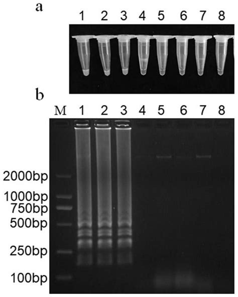 Lamp Loop Mediated Isothermal Amplification Detection Primer Kit And Lamp Rapid Detection