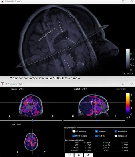 Issue With Seegecog Adding Electrodes Discussions Brainstorm