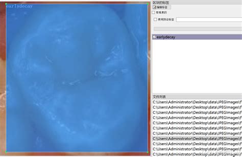 数据集 目标检测 牙齿健康状态检测数据集vocyolo格式2792张3类别牙齿数据集 Csdn博客