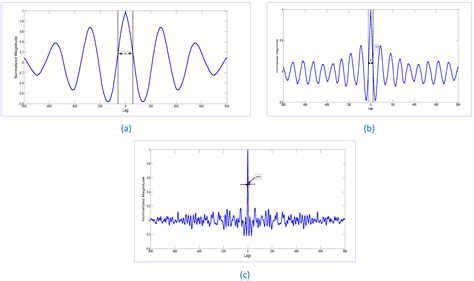 A Detailed Algorithm For Vital Sign Monitoring Of A Stationarynon