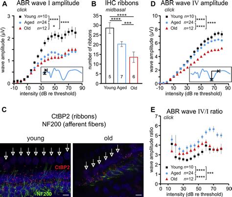 Age Related Cochlear Synaptopathy Can Be Centrally Compensated In
