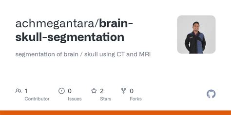 Brain Skull Segmentation Convert Dicom To Png Ipynb At Master