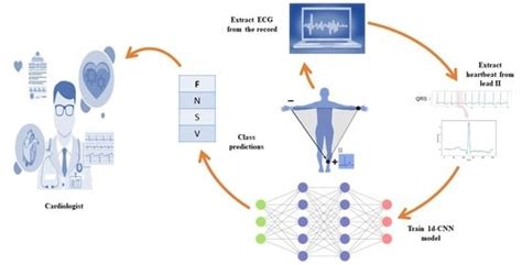 Classifying Cardiac Arrhythmia From Ecg Signal Using 1d Cnn Deep Learning Model