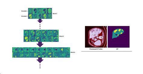 GitHub Sourjya Livertumor Segmentation W Net