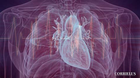 Heart Arrhythmia Causes Symptoms And Treatment