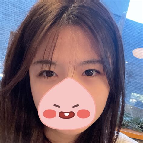 자유수다 원픽 오재윤원장님께 강남언니 1등 성형수술and피부시술 정보앱