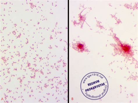 Salmonella Typhimurium Morphology