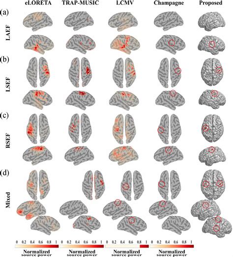 Source Localization Results Of Laef A Lsef B Rsef C And Mixed