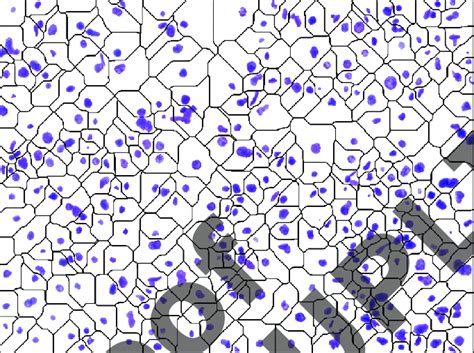 Illustration Of The Final Step Of The Watershed Algorithm Application Download Scientific Diagram
