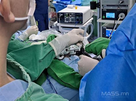 УНТЭ анх удаа амны хүрцээр бамбай булчирхайн зангилаа авах дурангийн мэс заслыг амжилттай хийлээ