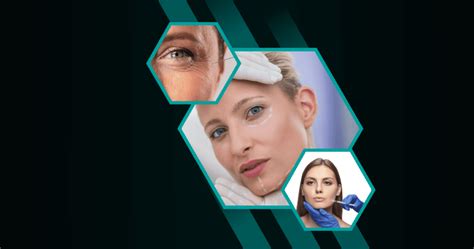Botox Long Term Effects What You Need To Know 2025