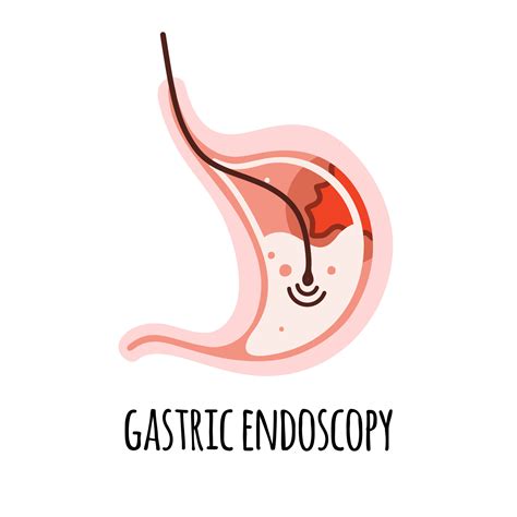Gastric Ulcer Endoscopy