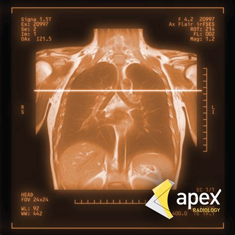 Apex Radiology Appointment Bookings