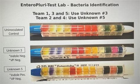 Enteropluri Test Lab Bacteria Identification Team