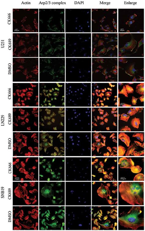 Localization Of The Arp Complex And Actin In Glioma Cells Following Download Scientific