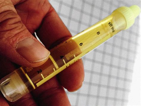 Syphilis Treatment Pills