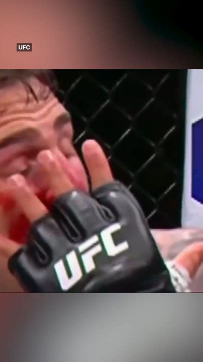 Fingers Buried Into Ufc Champs Eye Socket Au — Australias