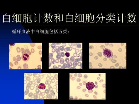 白细胞计数和白细胞分类计数ppt Word文档在线阅读与下载 免费文档