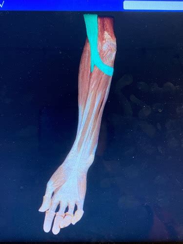 Forearm And Hand Anterior Flashcards Quizlet