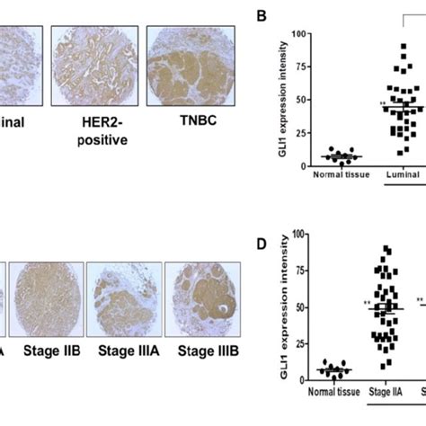 analysis of glioma associated oncogene 1 gli1 expression in a tissue