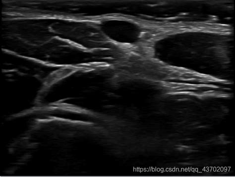 数字图像处理项目：光流法追踪角点calcopticalflowpyrlk，goodfeaturestotrack