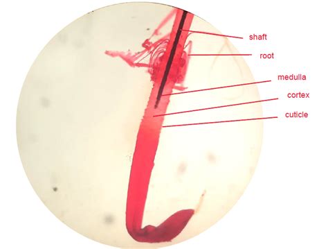 Answered Shaft Root Medulla Cortex Cuticle Bartleby