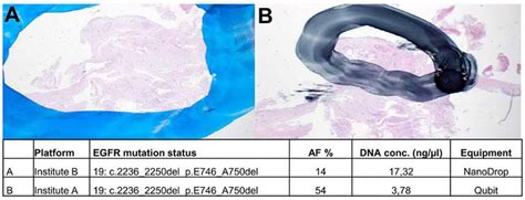 Macrodissection Tumor Cells On Hande Stained Slides Were Marked By Download Scientific Diagram Macrodissection Tumor Cells On Hande Stained Slides Were Marked By Download Scientific Diagram