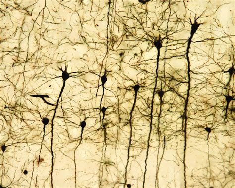A Layer Of Pyramidal Neurons In The Cerebral Cortex License Download Scientific Diagram