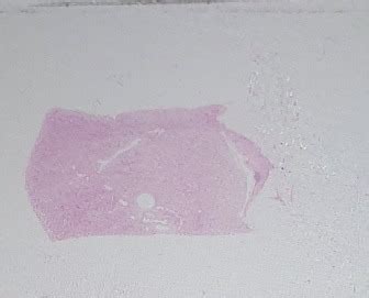 Urogenital System Flashcards Quizlet