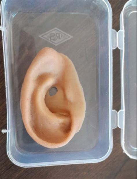 Silicone Ear Prosthesis At ₹ 45000 Silicone Ear Prosthesis In