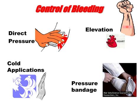 What Are The Key Steps In Bleeding Control At Johnny Moe Blog