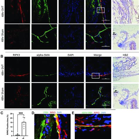 Receptor Interacting Protein Kinase 3 Ripk3 Accumulates In The Vein Download Scientific