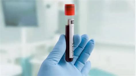 Fungsi Eritrosit Leukosit Trombosit Penting Untuk Tubuh Hot Liputan6 Com