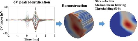 Left Typical Demodulated Eit Traces From Multiple Injection Pairs And Download Scientific