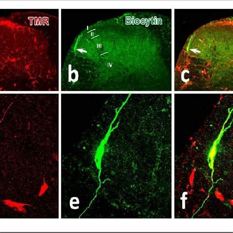 Identification Of The Patch Clamp Recorded Projection Neurons By Download Scientific Diagram