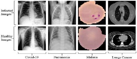 Figure 2 From Stacked Bilstm With Resnet50 For Medical Image Classification Semantic Scholar