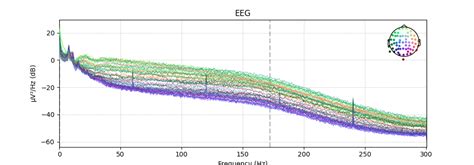 Transform Eeg Data Using Current Source Density Csd — Mne 0221 Documentation