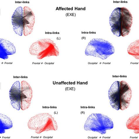 Brain Networks Constructed From Scalp Eeg Signals During Movement Download Scientific Diagram
