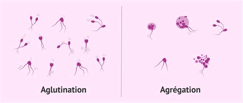 Différence Entre Agglutination Spermatique Et Agrégation
