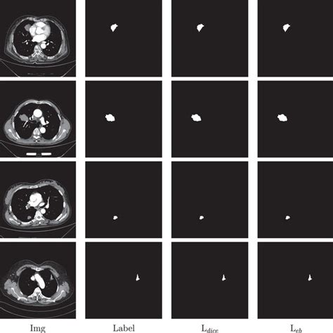 Four Ct Slices With Different Locations Sizes And Shapes Of Lung